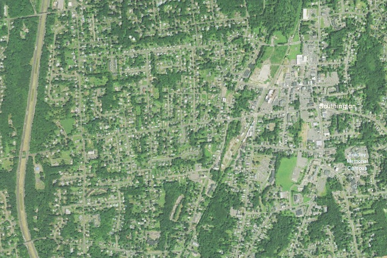 Patient admitted after major back surgery in Plantsville, Southington ...