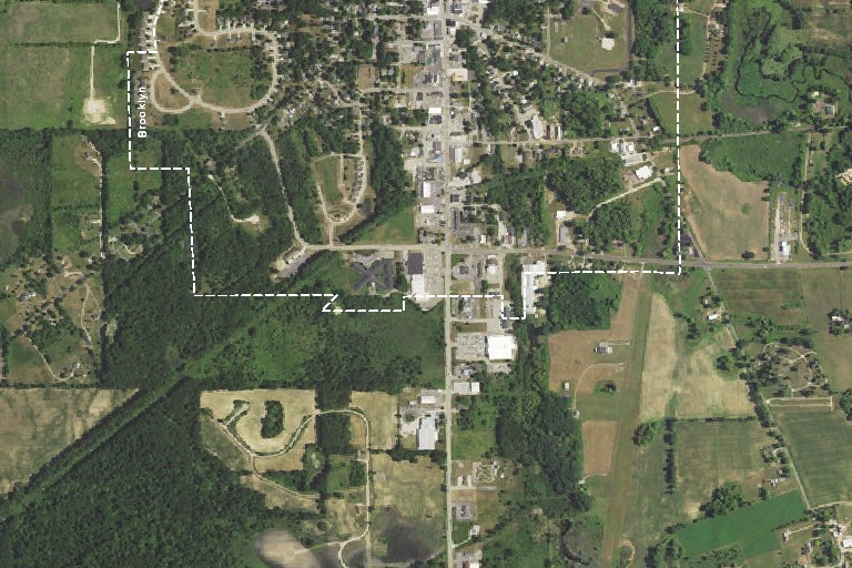 Person bleeding heavily from leg laceration at medical center, Brooklyn ...