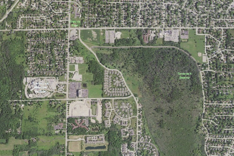 Elderly man extremely weak after hip surgery, Menomonee Falls WI ...