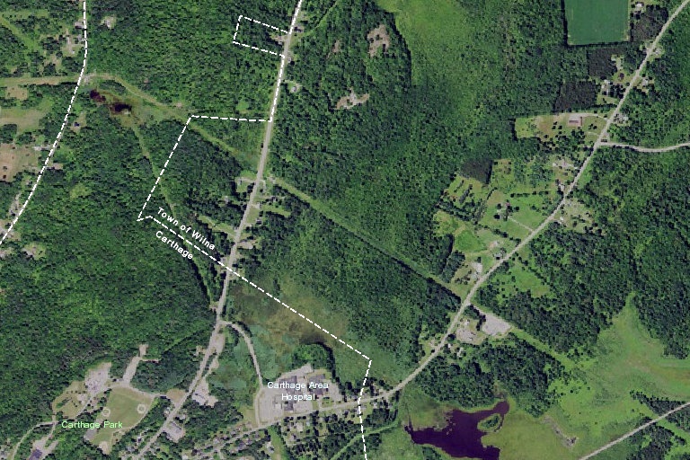 Male patient with swollen leg and altered mental status, Carthage NY ...