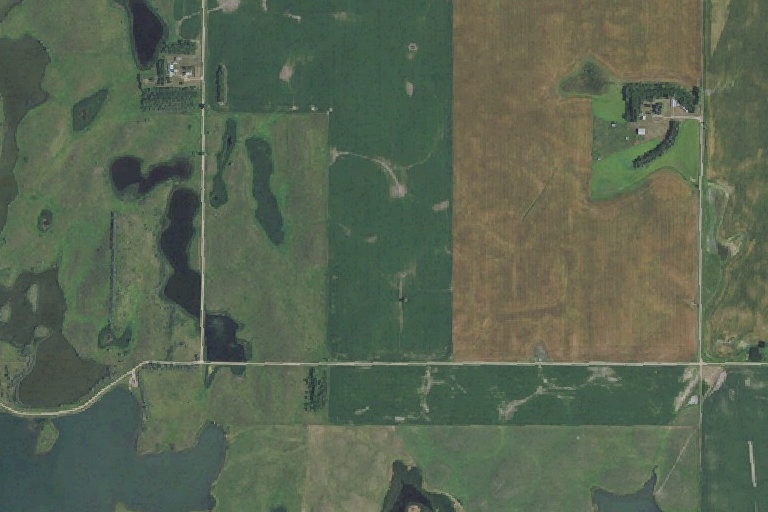 69-year-old male with leg swelling unable to walk, Mclean County ND ...