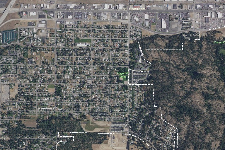 7-year-old female with chest pain and heart history, Spokane Valley WA ...